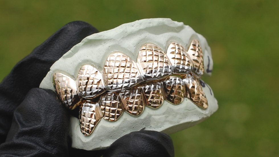 Custom Gold Teeth Grillz in Houston: Why Do People Consider?