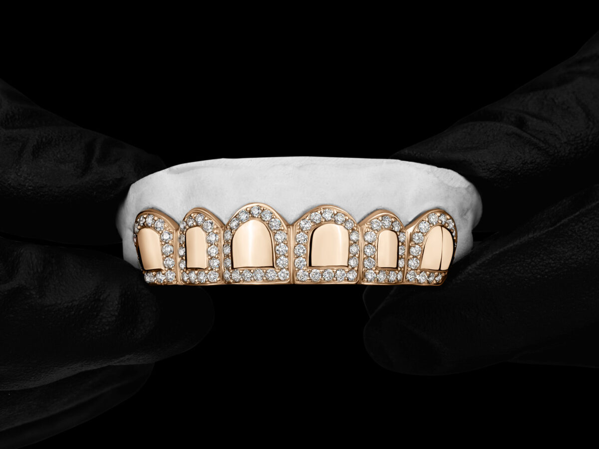 Open Face Gold Crown