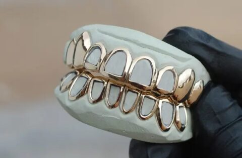 Custom Gold Grillz | Custom Diamond Teeth Grillz Online