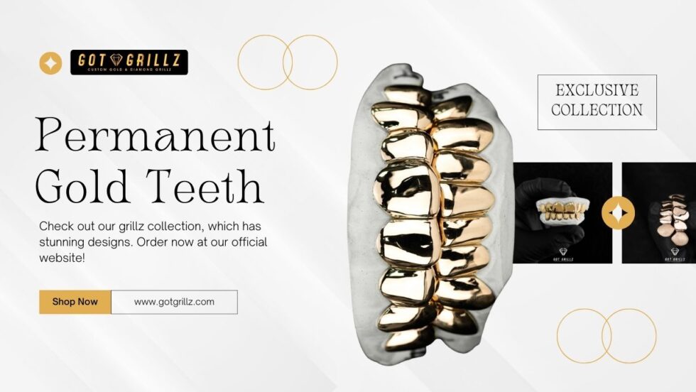 Where Can I Get Permanent Gold Teeth? Exploring Your Options