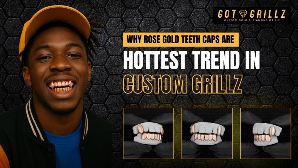 Why Rose Gold Teeth Caps Are Hottest Trend in Custom Grillz